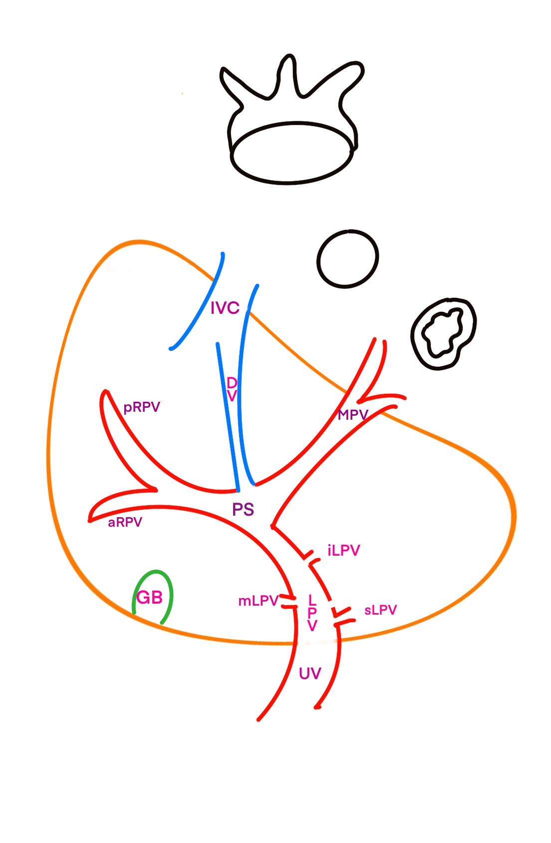 Fetal Umbilical–Portal–Systemic Venous Shunt – Fetal Cardiac Care