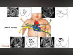 Exploring the V, U, and Y of the VT3 View – Fetal Cardiac Care
