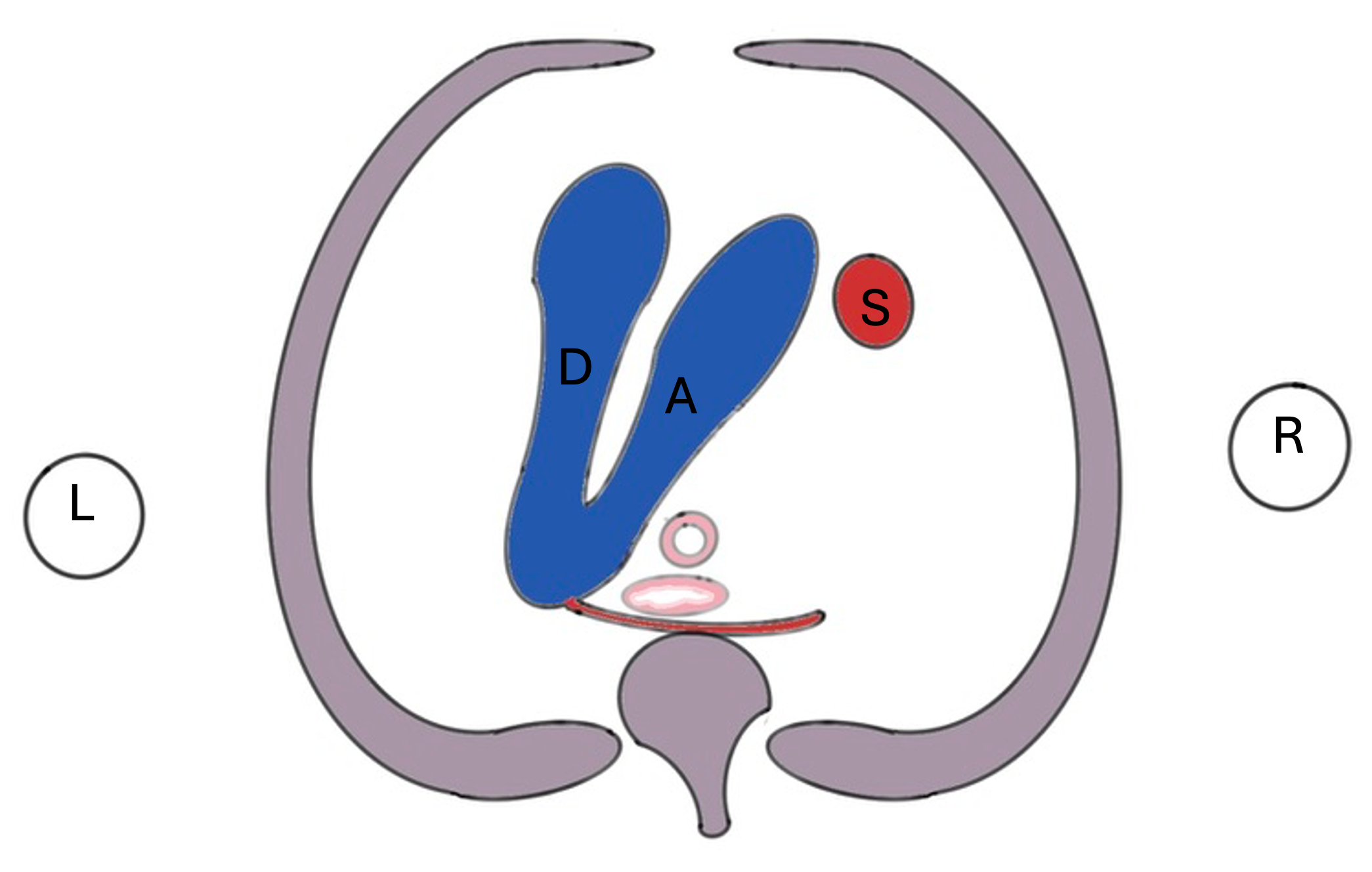 Exploring the V, U, and Y of the VT3 View – Fetal Cardiac Care