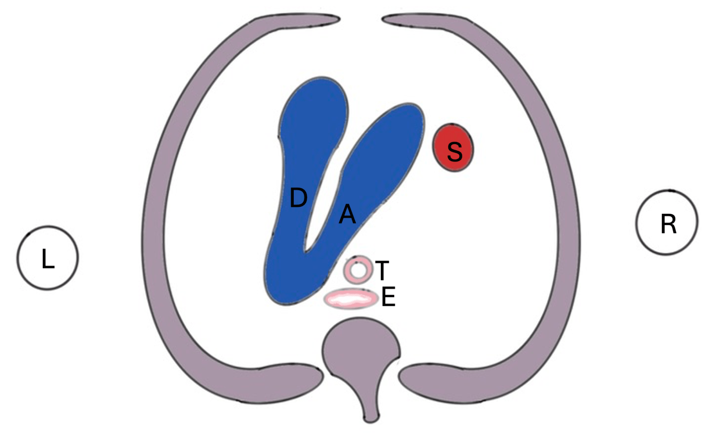 Exploring the V, U, and Y of the VT3 View – Fetal Cardiac Care