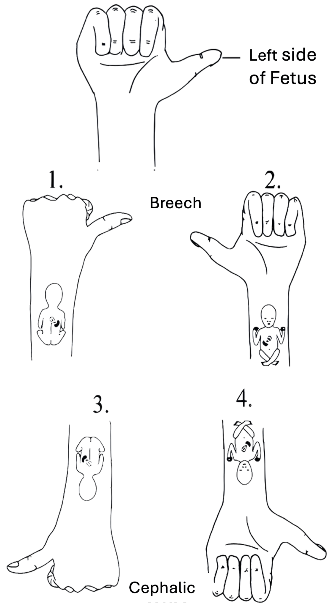 Fetal Situs Detection Simplified:A Practical Approach – Fetal Cardiac Care