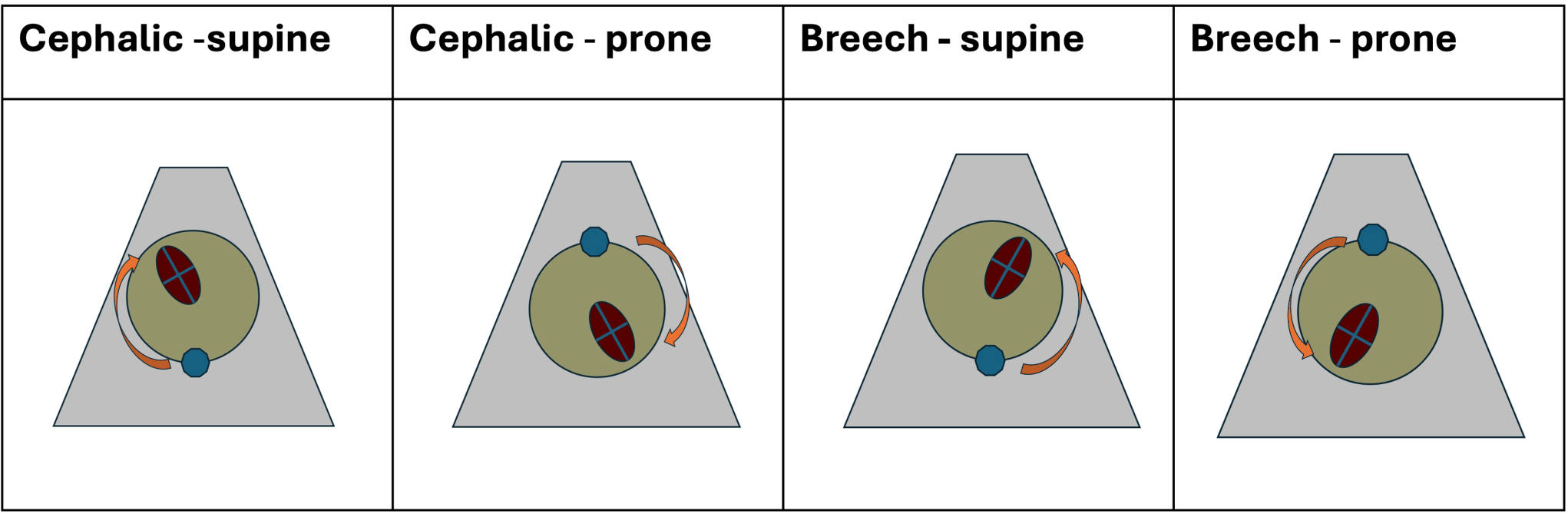 Fetal Situs Detection Simplified:A Practical Approach – Fetal Cardiac Care