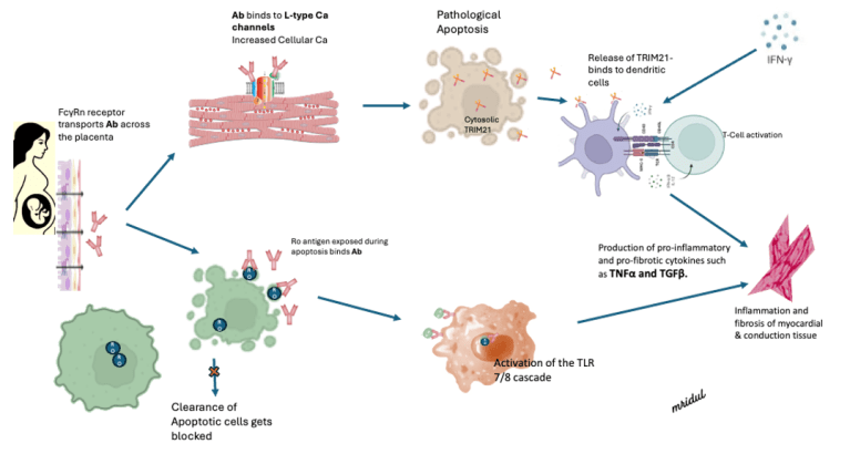 Fetal CHB and Maternal Autoimmunity: From Risk to Response – Fetal ...