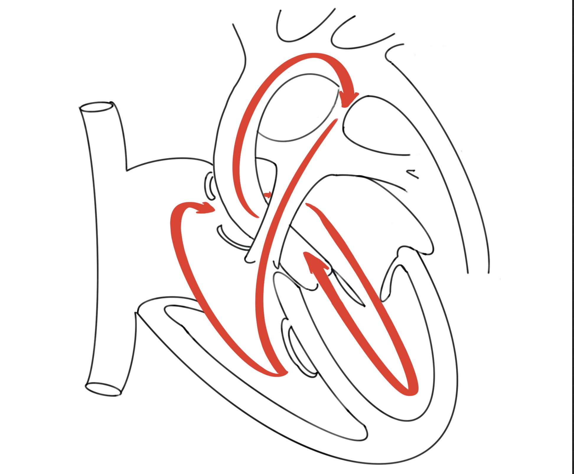 Fetal Ebstein Anomaly: Risk Markers of a Failing Right Heart – Fetal ...